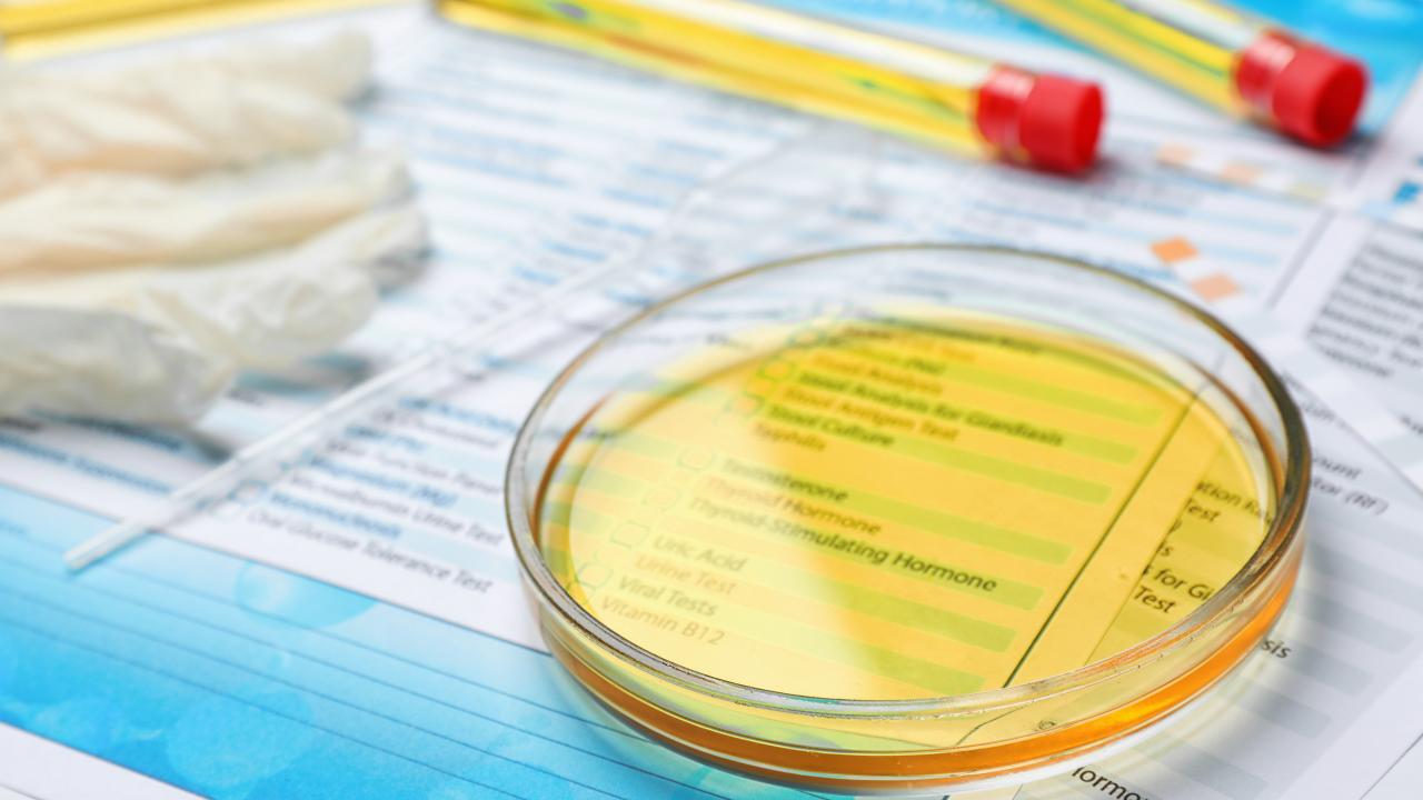 Introduction to Testing | UK Anti-Doping