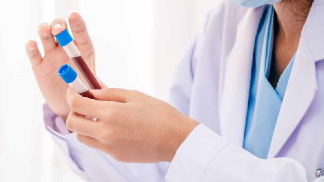 UKAD’s latest testing numbers show return to pre-pandemic levels | UK ...